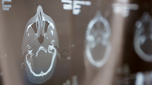 人类脑磁共振成像以轴视高清图片下载-正版图片505053219-摄图网