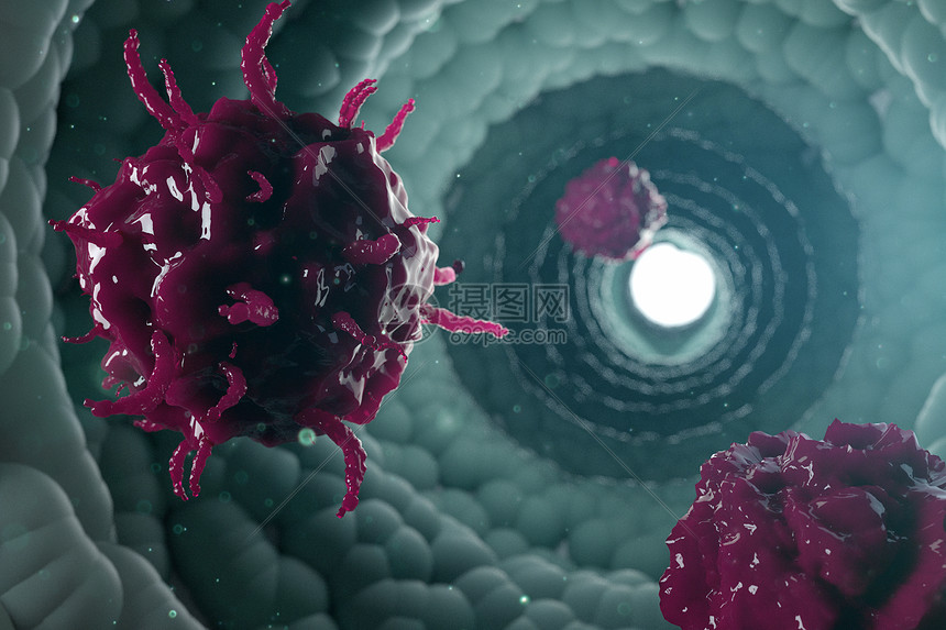 三维癌细胞入侵场景图片素材-正版创意图片402030318-摄图网