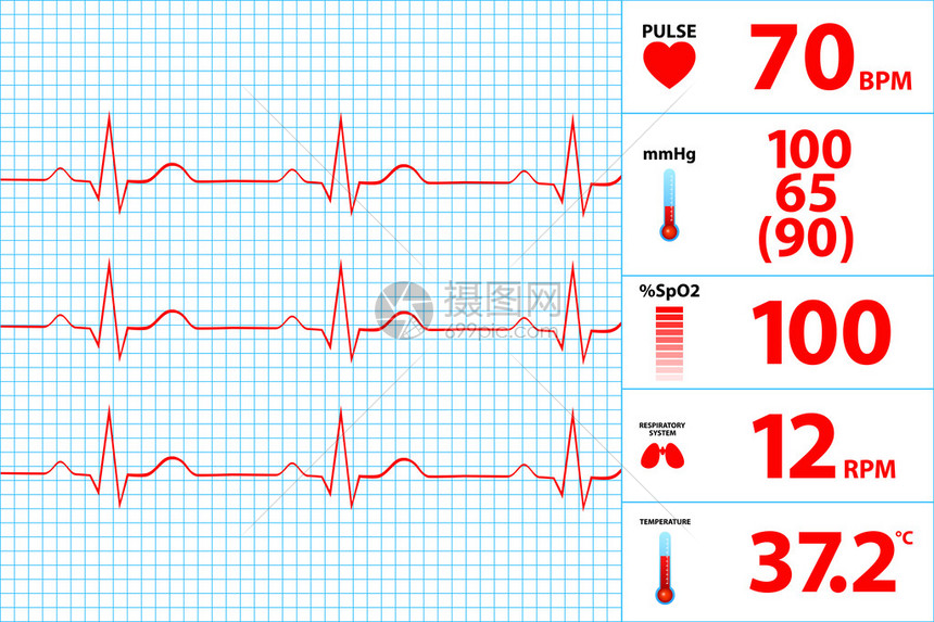 现代心电图显示器显示矢量图插画图片下载-正版图片402239566-摄图网