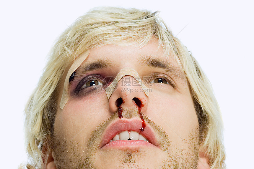面部受伤的男人高清图片下载-正版图片501477464-摄图网