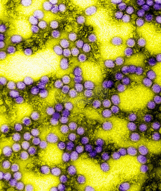 显微镜下的微生物高清图片下载-正版图片501838774-摄图网