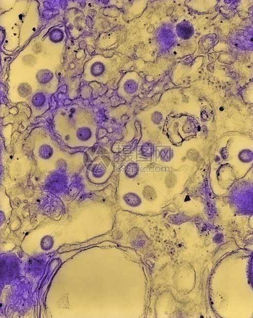 显微镜下的微生物高清图片下载-正版图片501838776-摄图网
