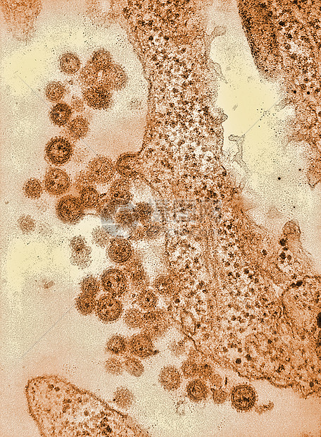 显微镜下的微生物高清图片下载-正版图片501838779-摄图网