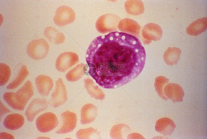 显微镜下的微生物高清图片下载-正版图片501838781-摄图网