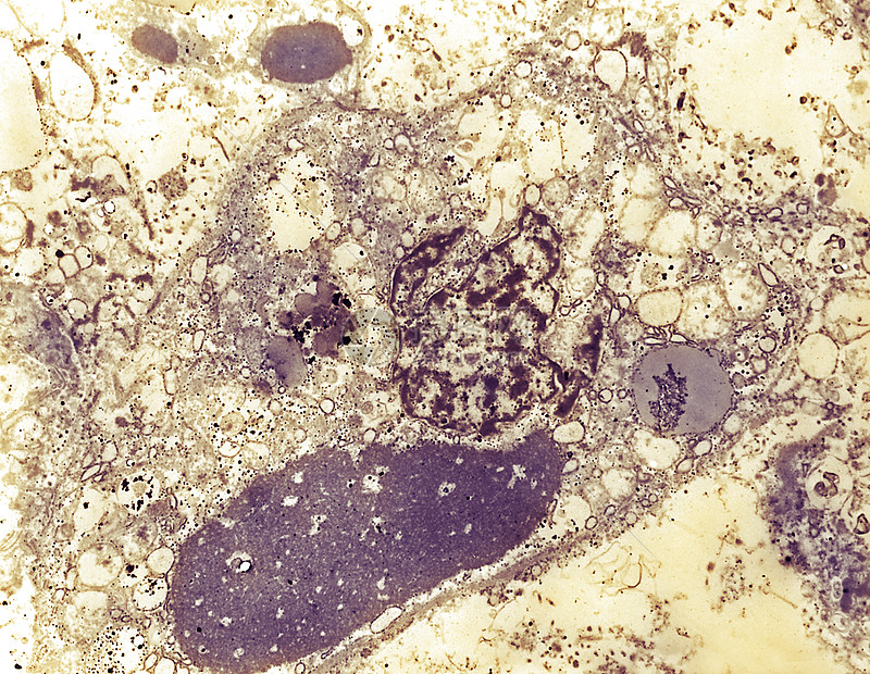 显微镜下的微生物高清图片下载-正版图片501838782-摄图网