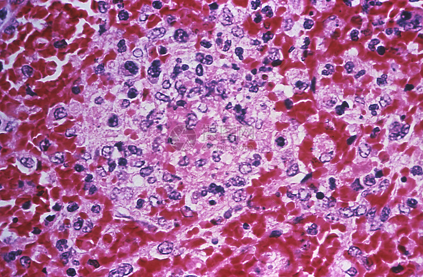 显微镜下的微生物高清图片下载-正版图片501838783-摄图网
