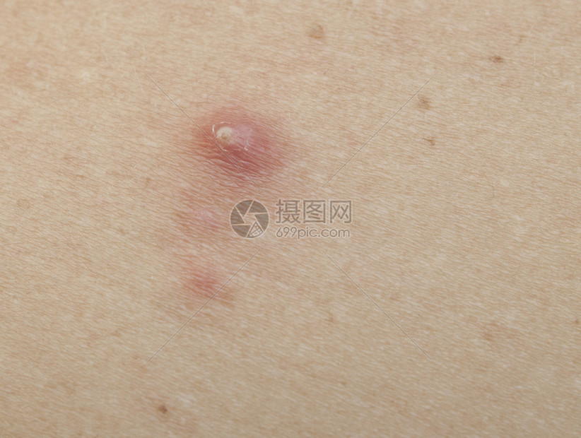 人体皮肤的poper高清图片下载-正版图片503041980-摄图网