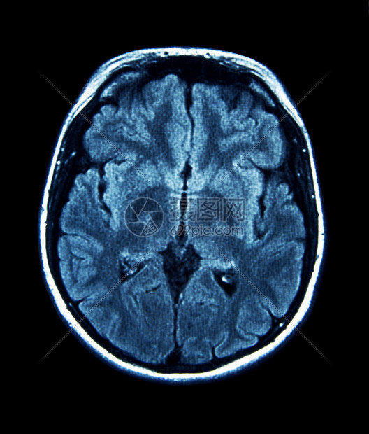 脑部核磁高清图片下载-正版图片503074264-摄图网