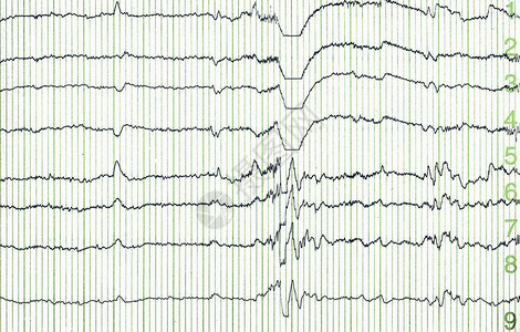 eeg图片_eeg素材_eeg高清图片_摄图网图片下载