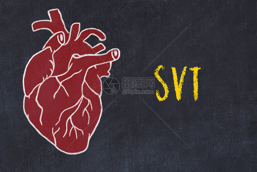 在黑纸板和刻字SVT上高清图片下载-正版图片503696384-摄图网