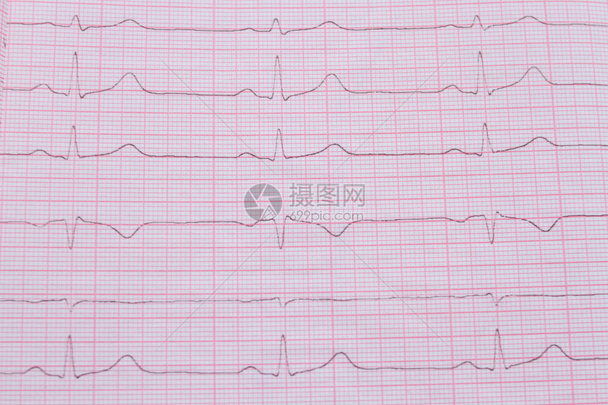 在纸上贴近ECG心电图脉冲图高清图片下载-正版图片503700596-摄图网