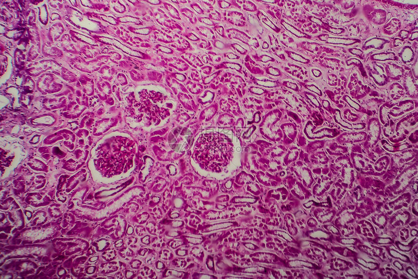 球状光显微成像仪显微镜下照片的弥散细胞高清图片下载-正版图片504416657-摄图网