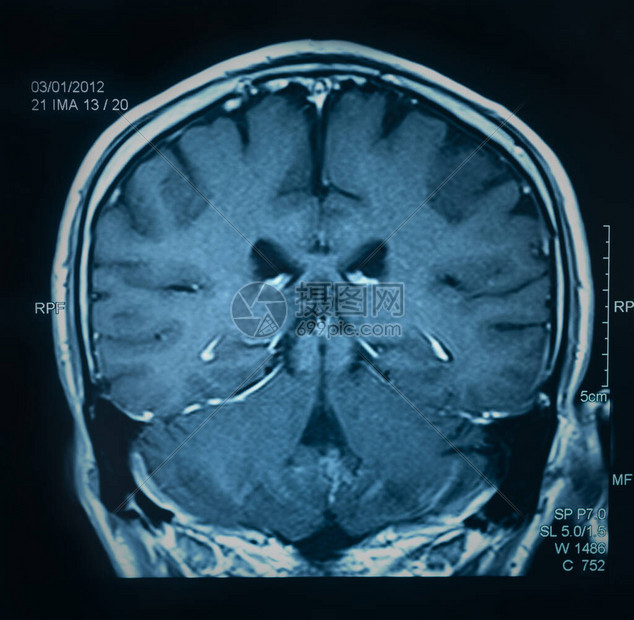 磁共振图像大脑的mri扫描高清图片下载-正版图片504456621-摄图网