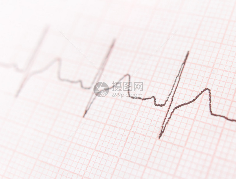 心电图ECG高清图片下载-正版图片504761302-摄图网
