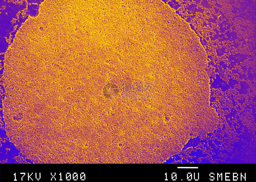 显微镜下的人型支原体高清图片下载-正版图片504809253-摄图网