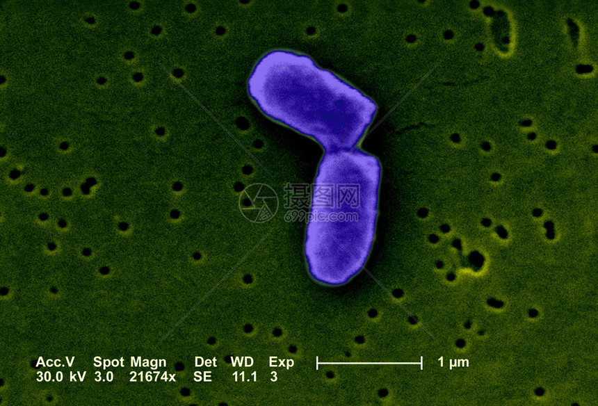 显微镜下的大肠杆菌高清图片下载-正版图片504809277-摄图网