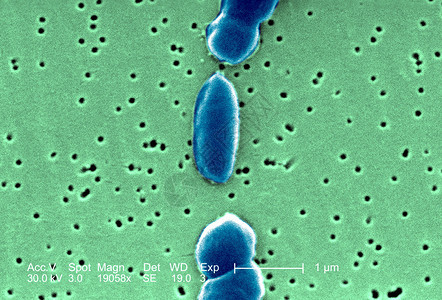 显微镜下的细菌高清图片下载-正版图片504809278-摄图网