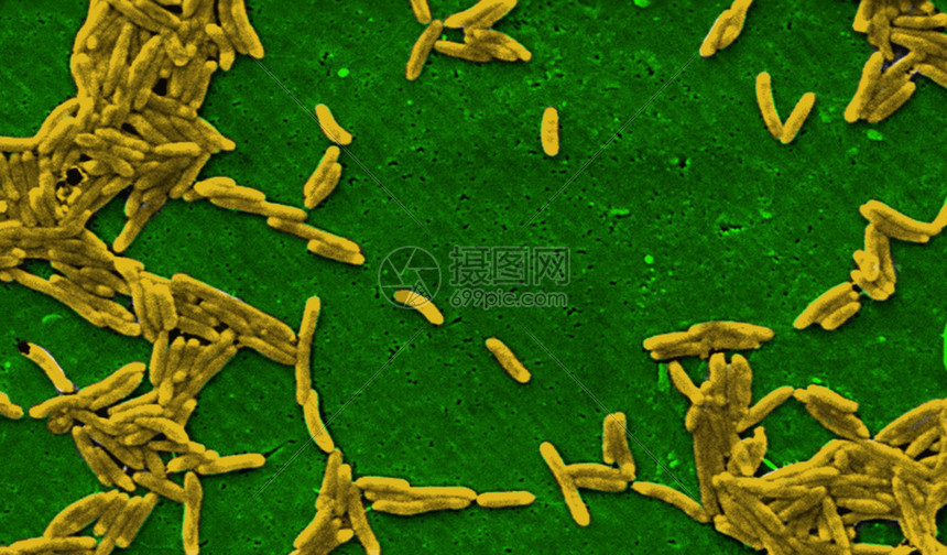 显微镜下的细菌高清图片下载-正版图片504809283-摄图网