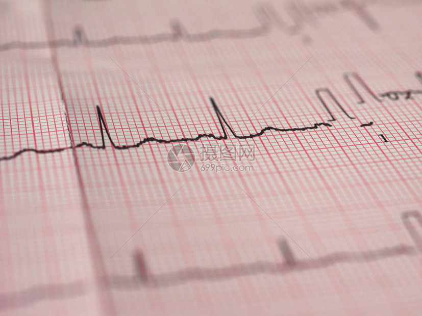 心电图ECG又名EKGElektrokardiogramm测量心跳高清图片下载-正版图片504981751-摄图网