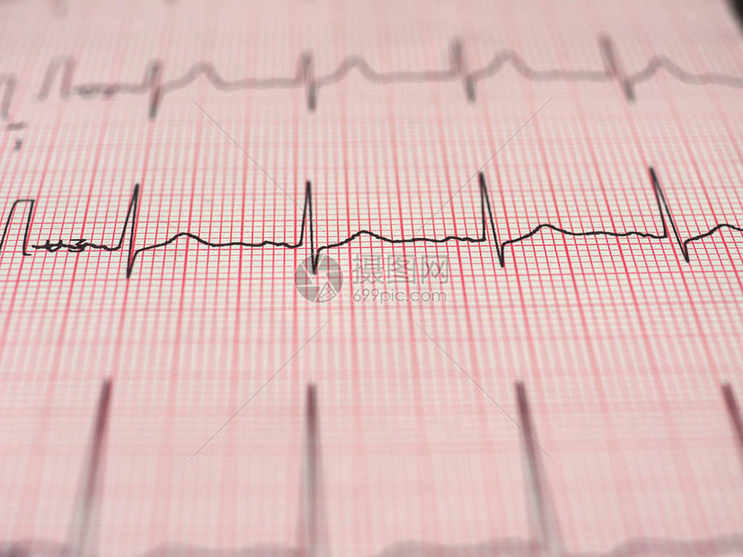 心电图ECG又名EKGElektrokardiogramm测量心跳高清图片下载-正版图片504982504-摄图网