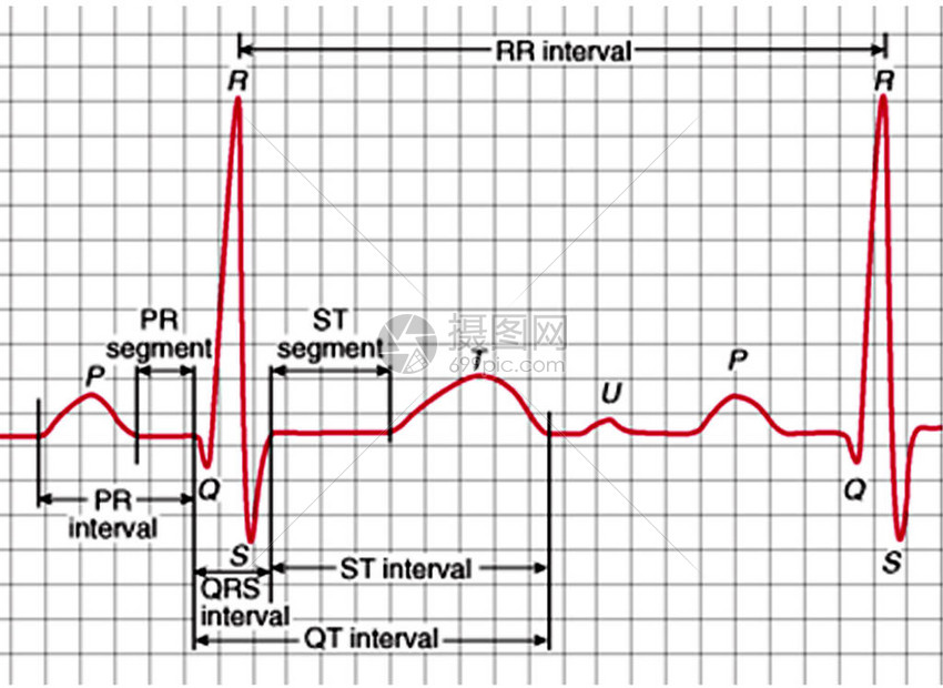 具有标记的QRS复合体高清图片下载-正版图片505006073-摄图网