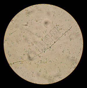 有氧真菌显微镜视图Aspergillusniger选择高清图片下载-正版图片506158758-摄图网