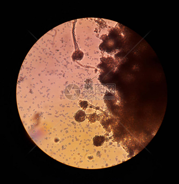 微显视图下的真菌Asper高清图片下载-正版图片505881892-摄图网