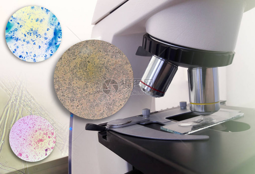 背景为显微镜图像的显微镜照片高清图片下载-正版图片506008012-摄图网