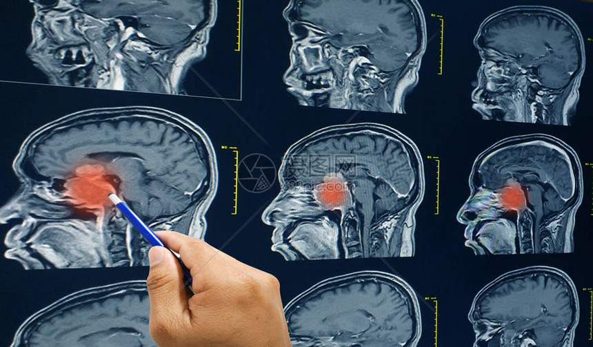 脑电磁共振成像MRI高清图片下载-正版图片506224950-摄图网