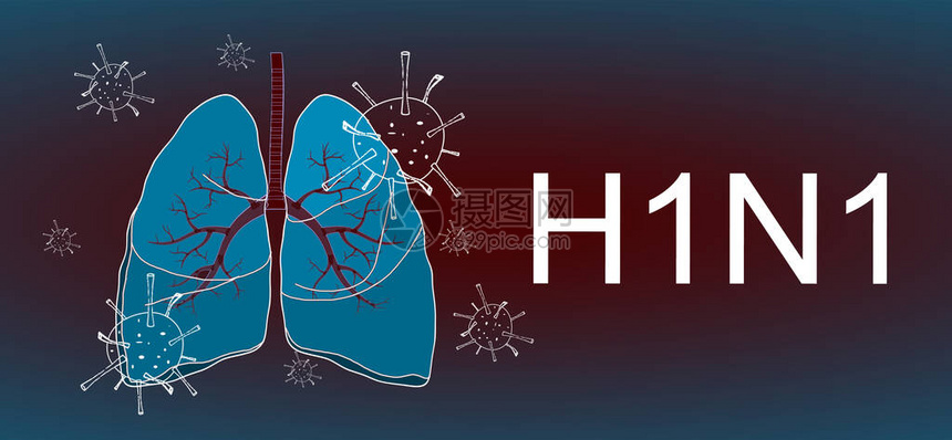 H1N1流感病高清图片下载-正版图片506728057-摄图网