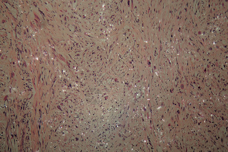 显微镜下的人类卵巢细胞和Ovari高清图片下载-正版图片507361804-摄图网