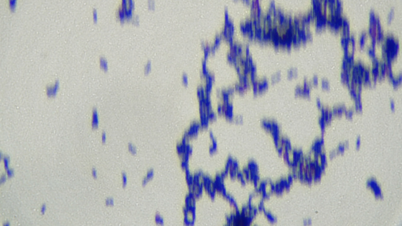 查看显微镜下的细菌mov格式视频下载_正版视频编号3878695-摄图网