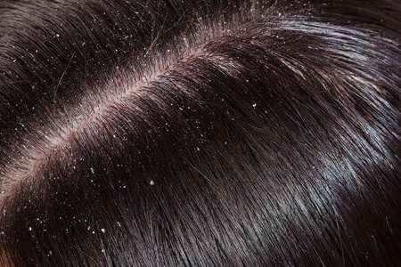 女性荷尔蒙图片-女性荷尔蒙素材-女性荷尔蒙插画-摄图新视界