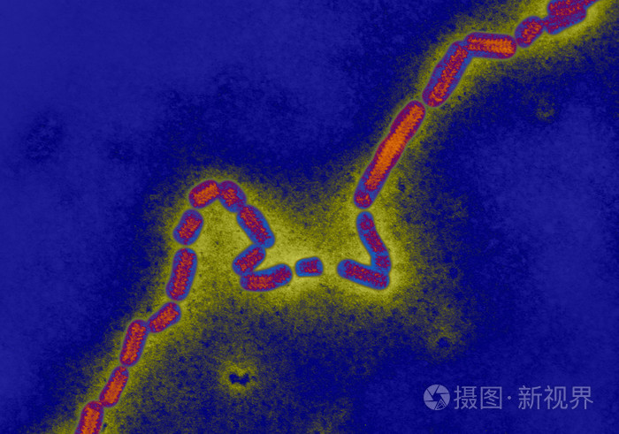 在显微镜下的微生物照片-正版商用图片1fdyfp-摄图新视界
